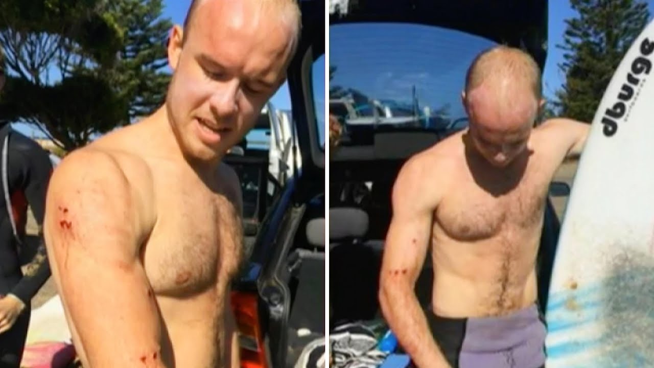 Surfer escapes shark attack by punching it on the nose | Descrier News
